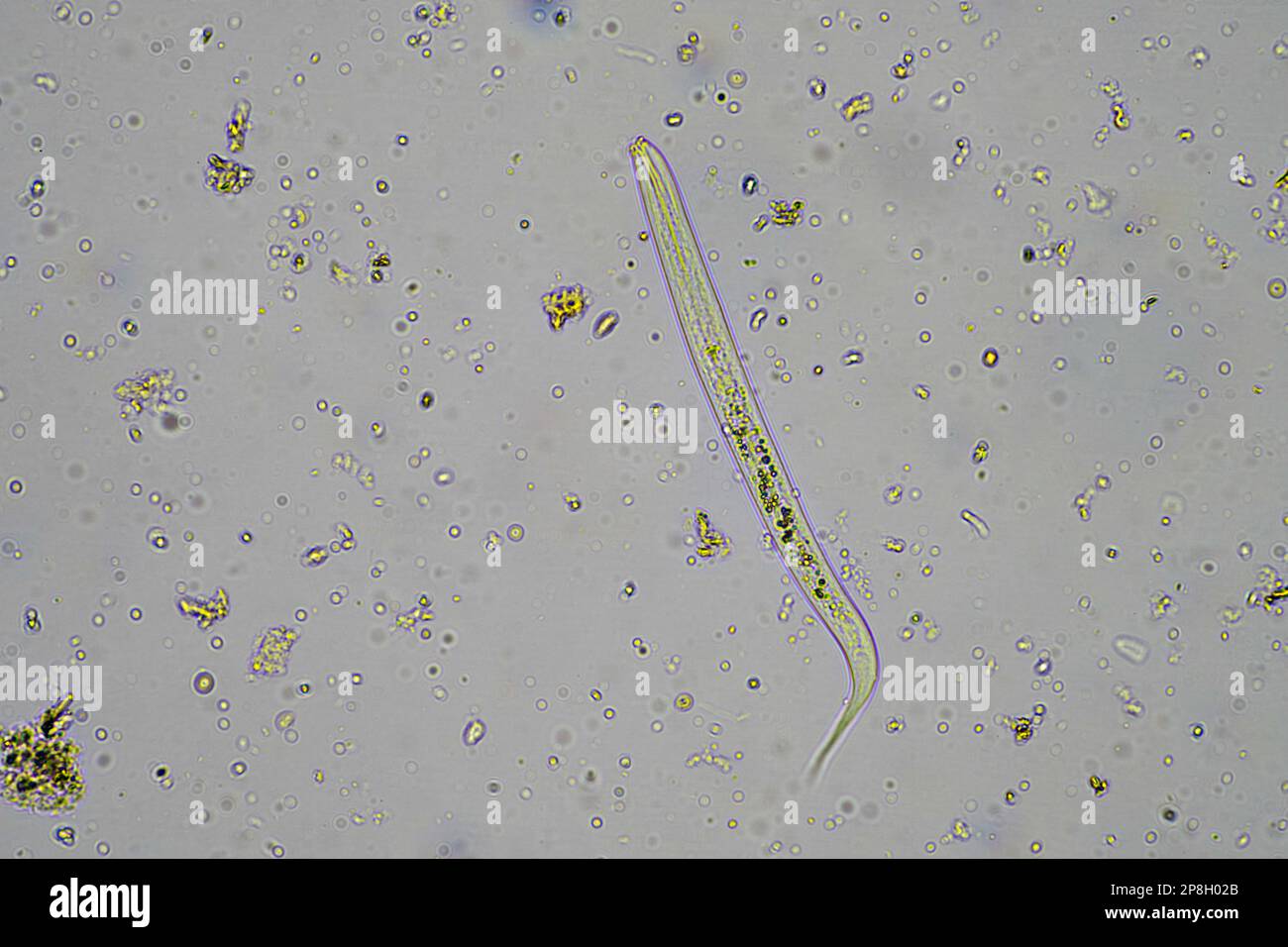 soil fungi, microorganisms and nematodes in a soil and compost sample ...