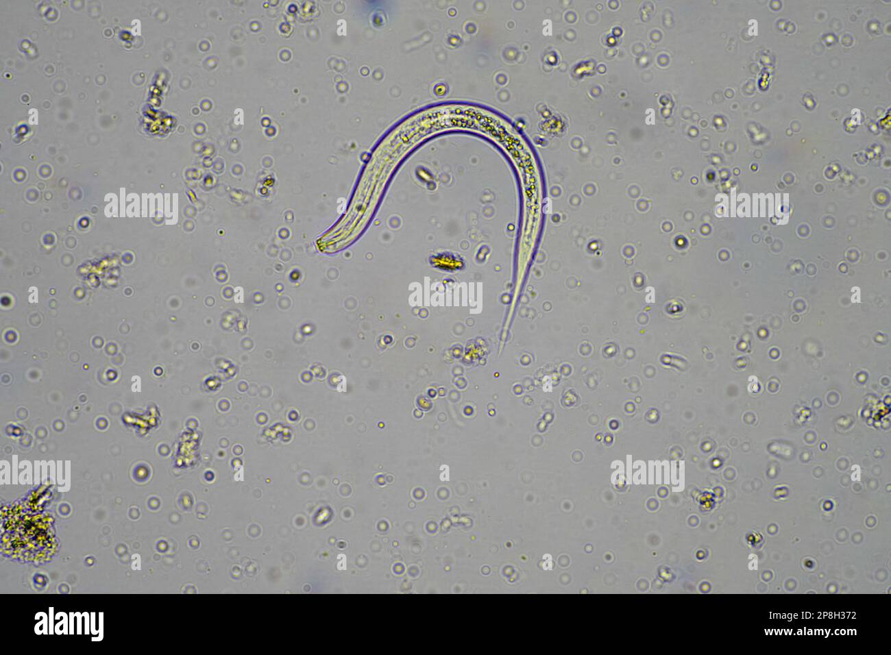 Nematode parasitic worm in microscope hi-res stock photography and ...