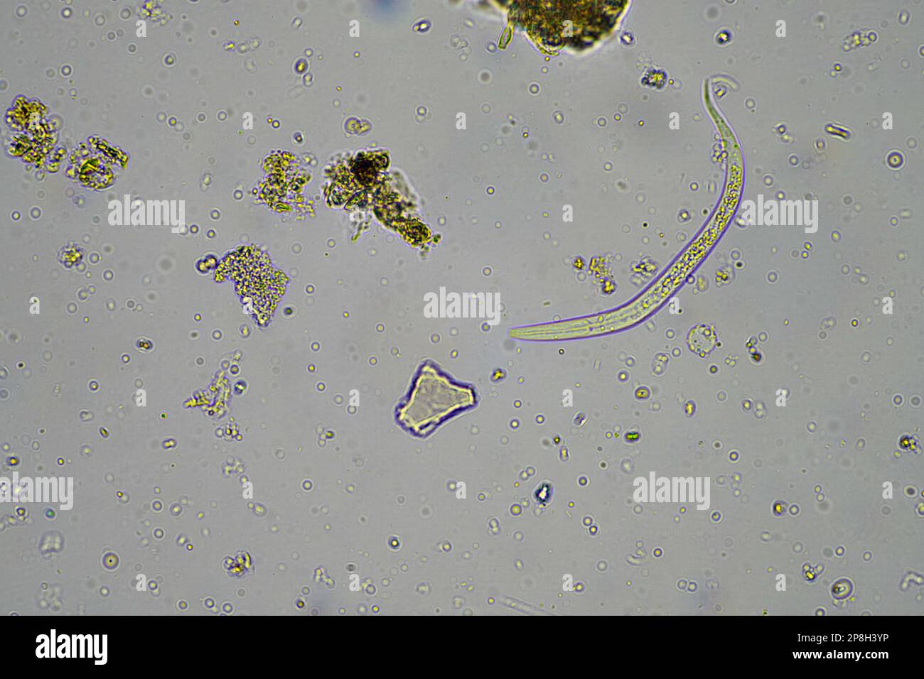 Microorganisms and biology in Compost and soil sample under the ...