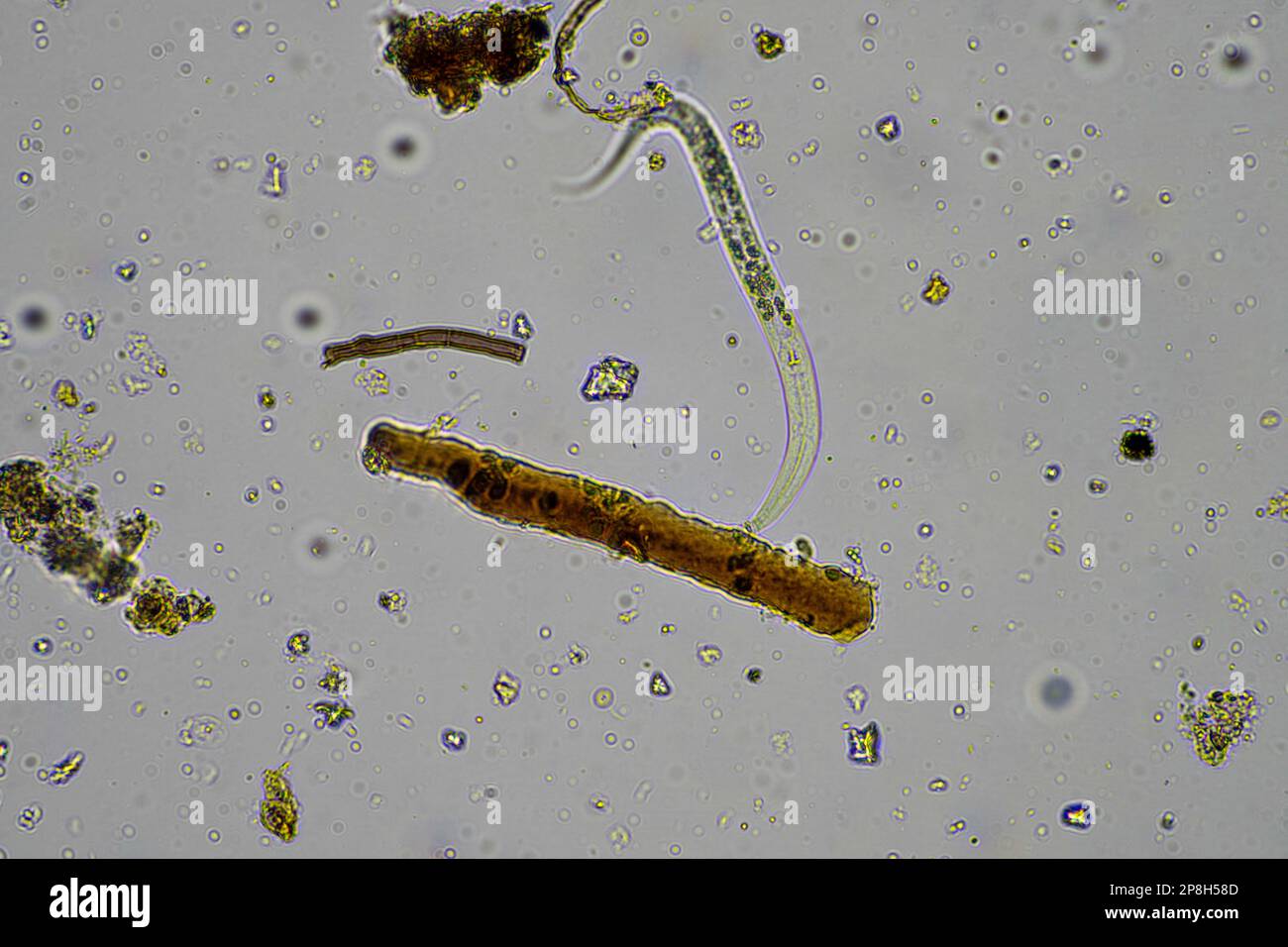 insect parasite in the soil in australia Stock Photo - Alamy