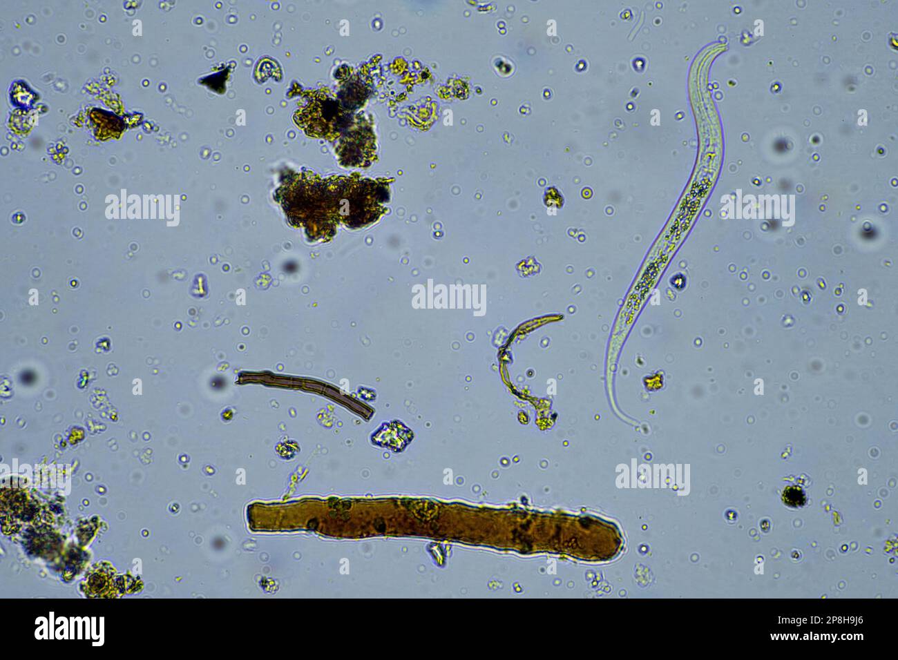 soil fungi, microorganisms and nematodes in a soil and compost sample ...