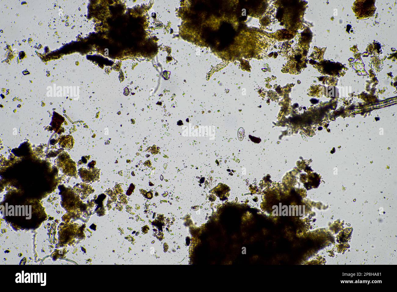 Microorganisms and biology in Compost and soil sample under the ...