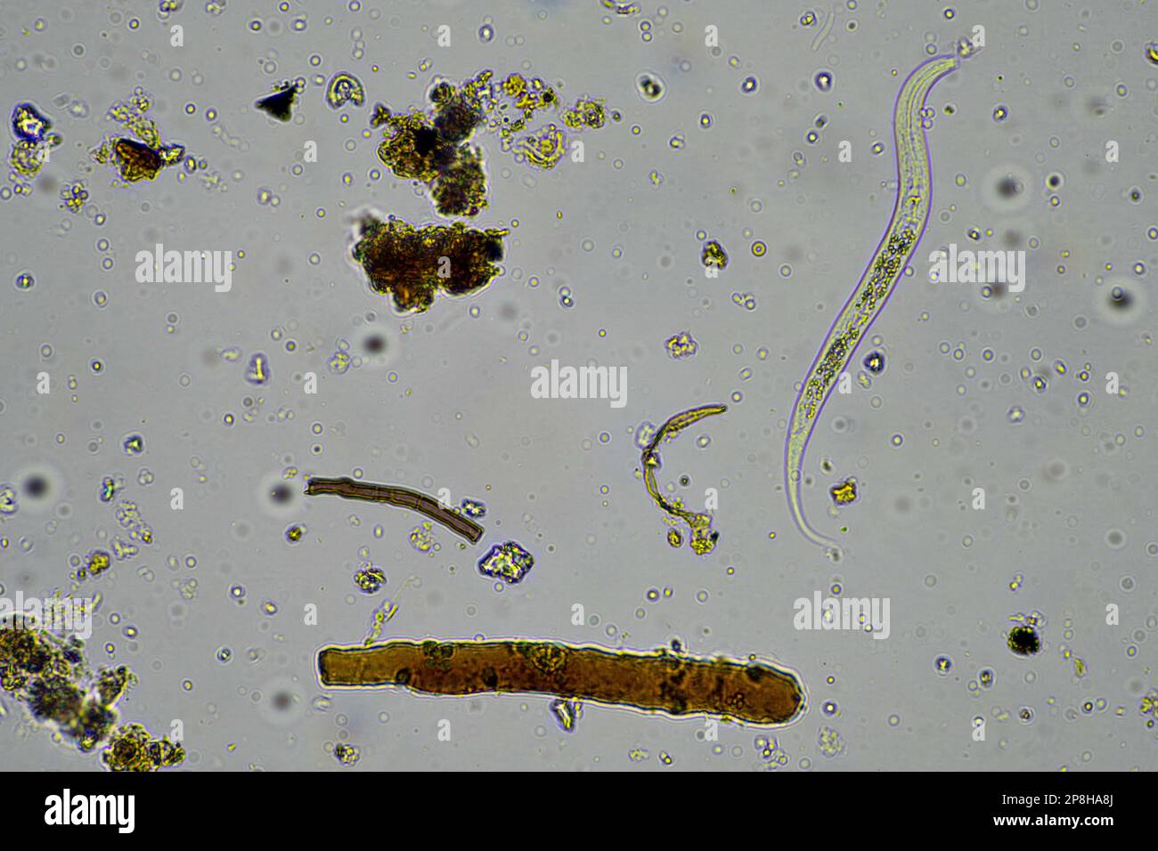 insect parasite in the soil in australia Stock Photo - Alamy