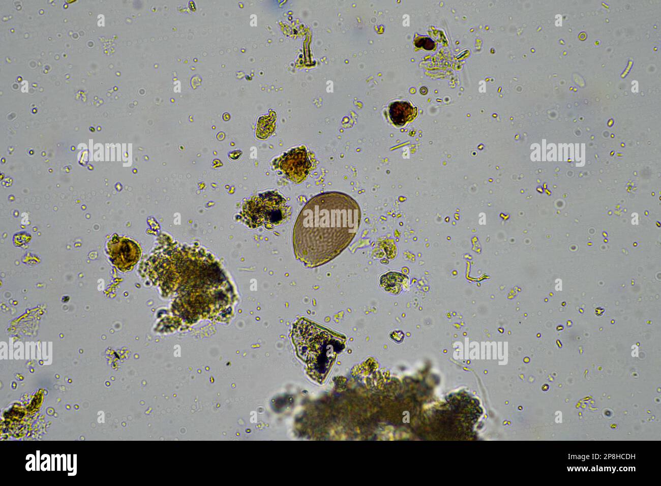 insect parasite in the soil in australia Stock Photo - Alamy