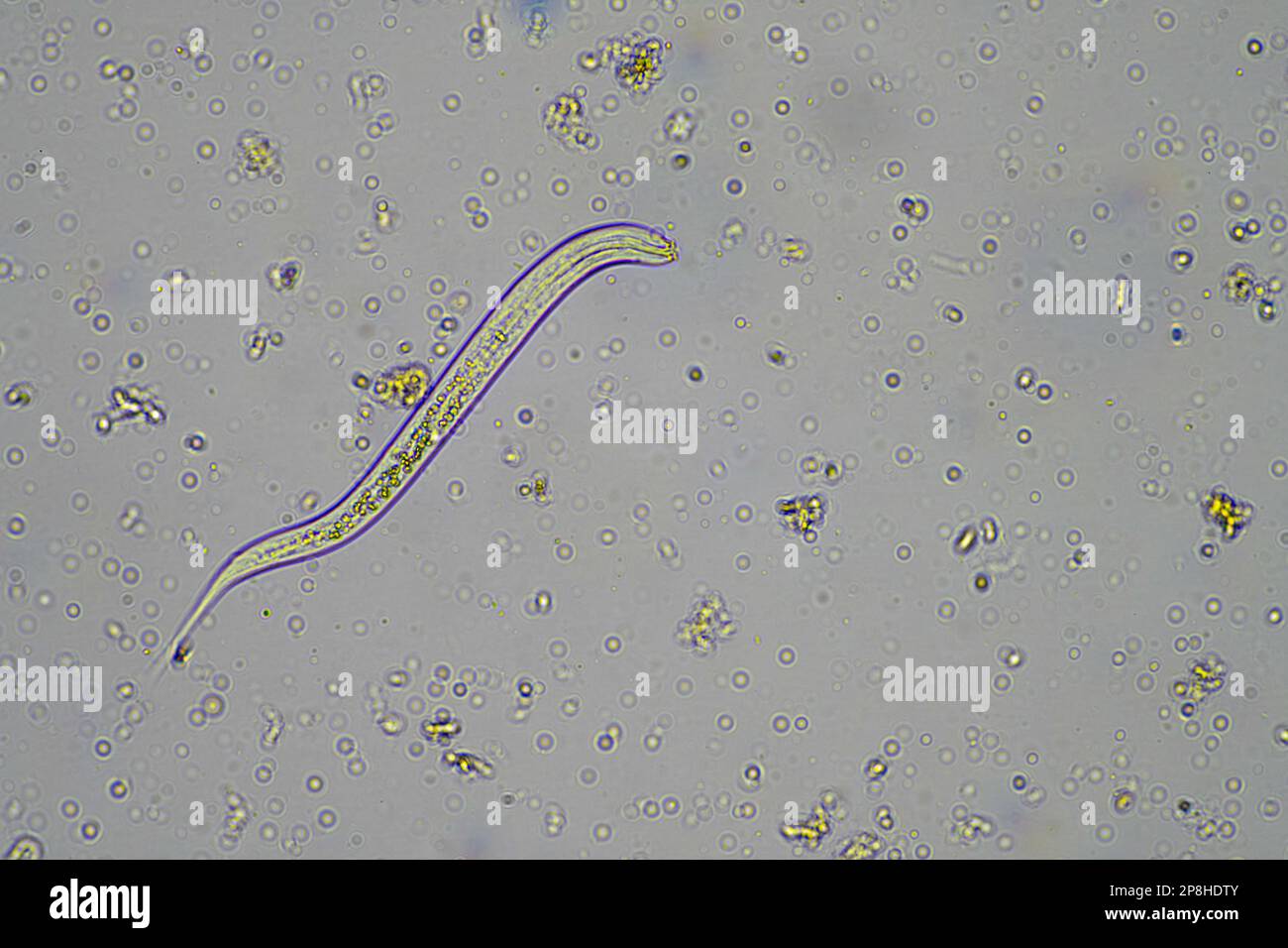 soil fungi, microorganisms and nematodes in a soil and compost sample ...