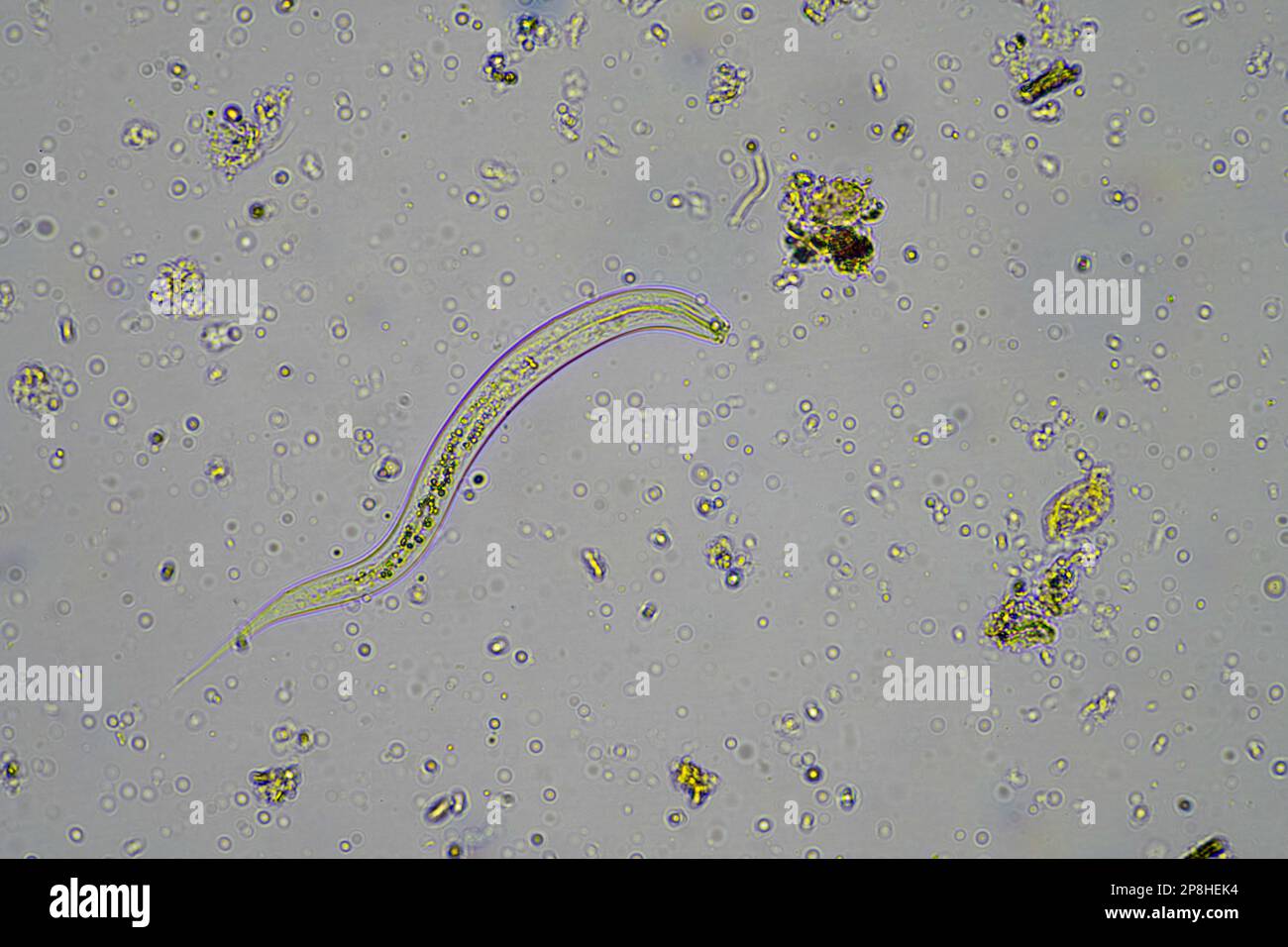 soil fungi, microorganisms and nematodes in a soil and compost sample ...