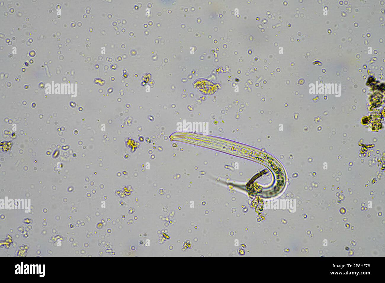 Microorganisms and biology in Compost and soil sample under the ...