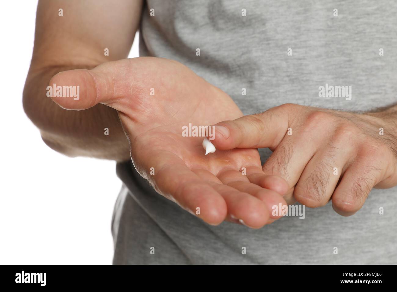 Man applying cream on hand for calluses treatment against white ...