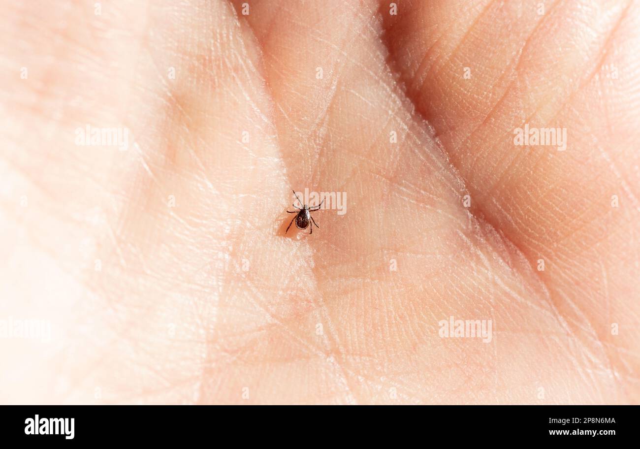 An animal Tick on a human hand Stock Photo - Alamy