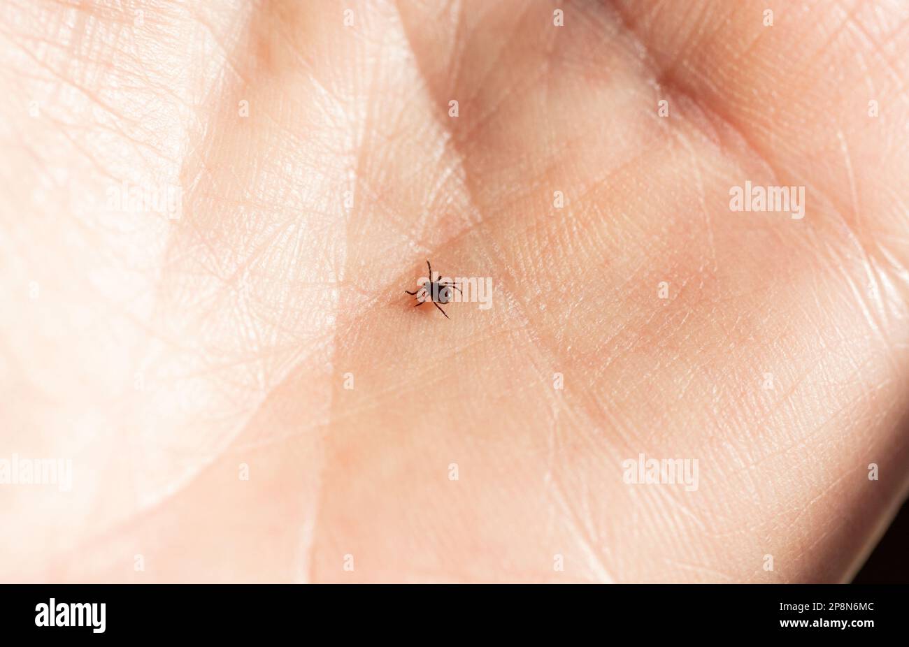 An animal Tick on a human hand Stock Photo - Alamy