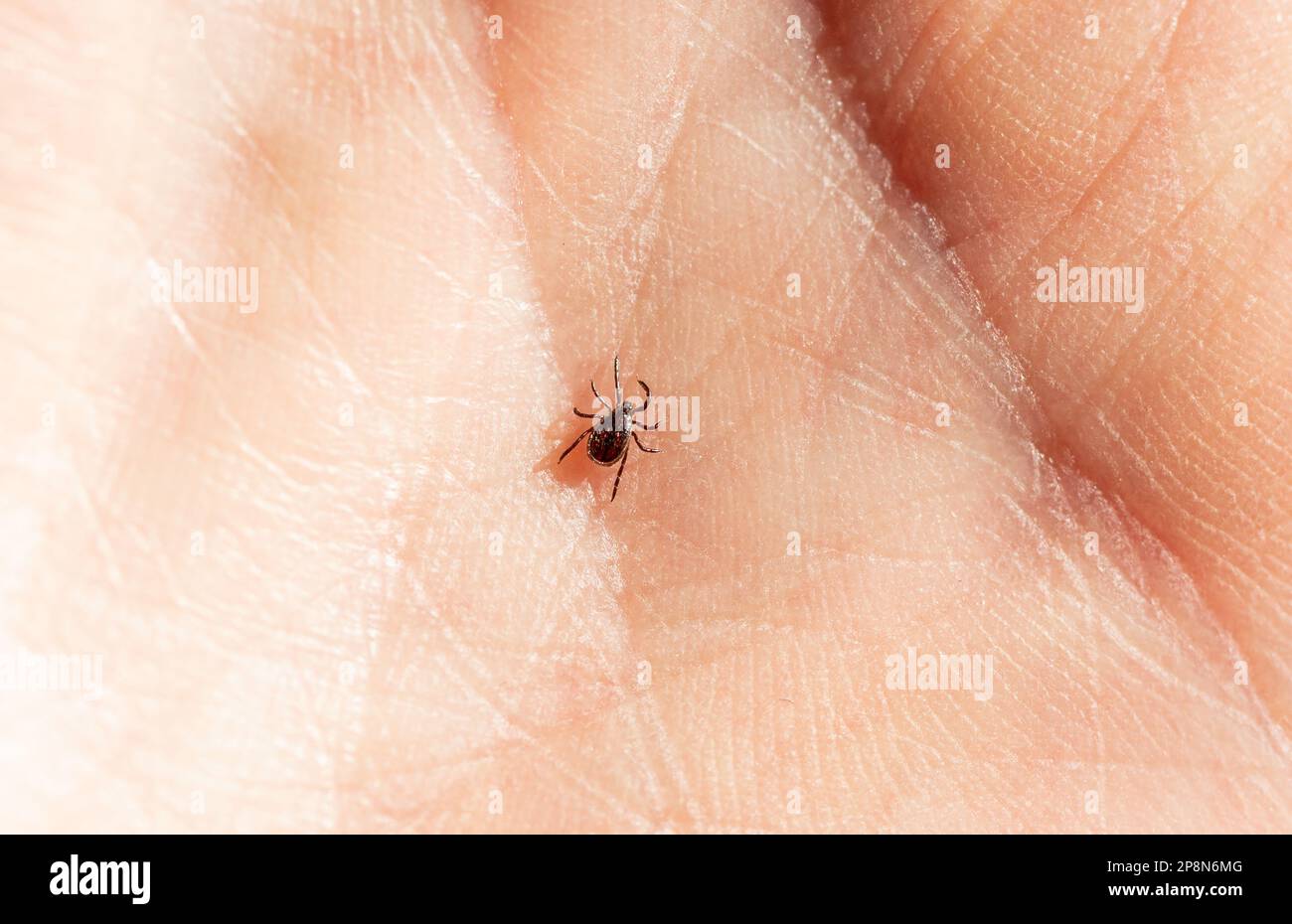 An animal Tick on a human hand Stock Photo - Alamy