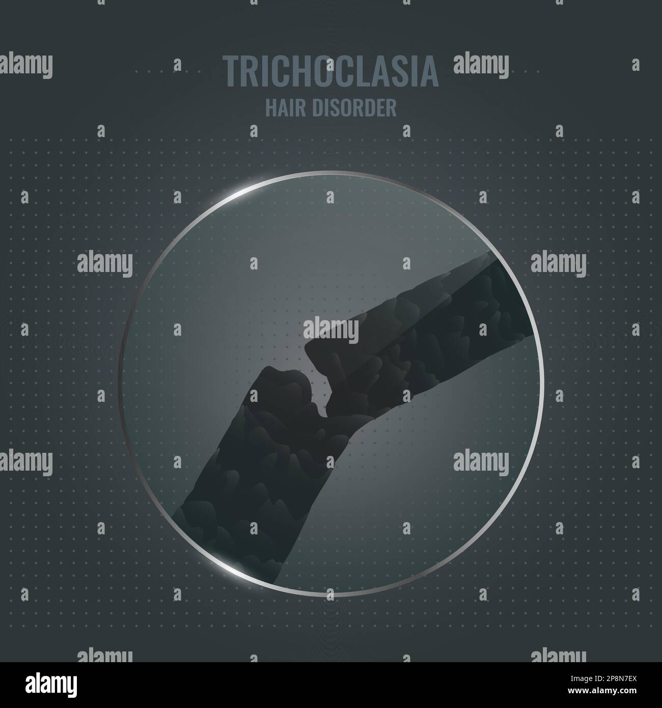 Trichoclasia hair brittle disorder in close up Stock Vector Image & Art ...