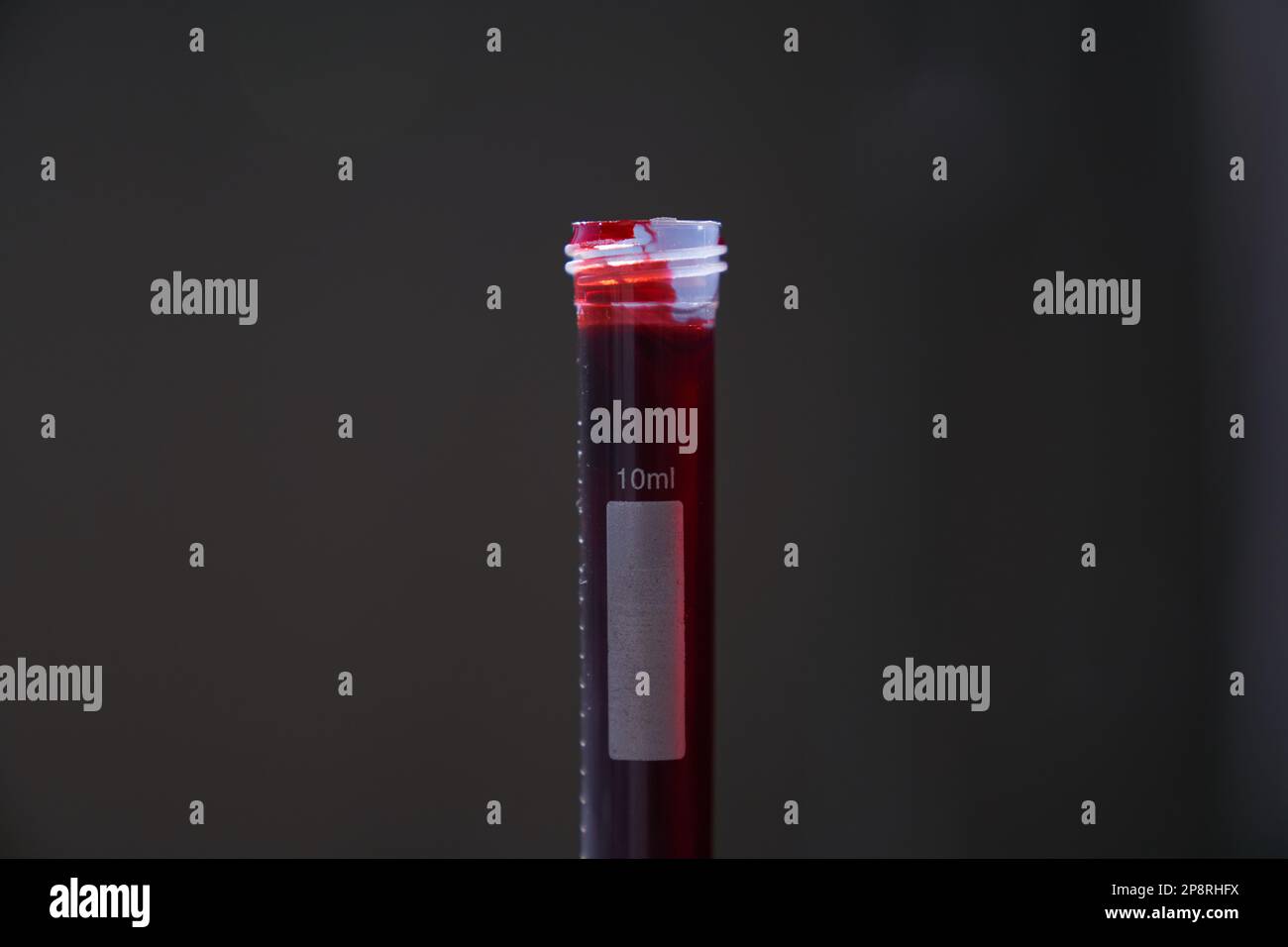 A test tube with blood on a dark background. Transparent test tubes ...