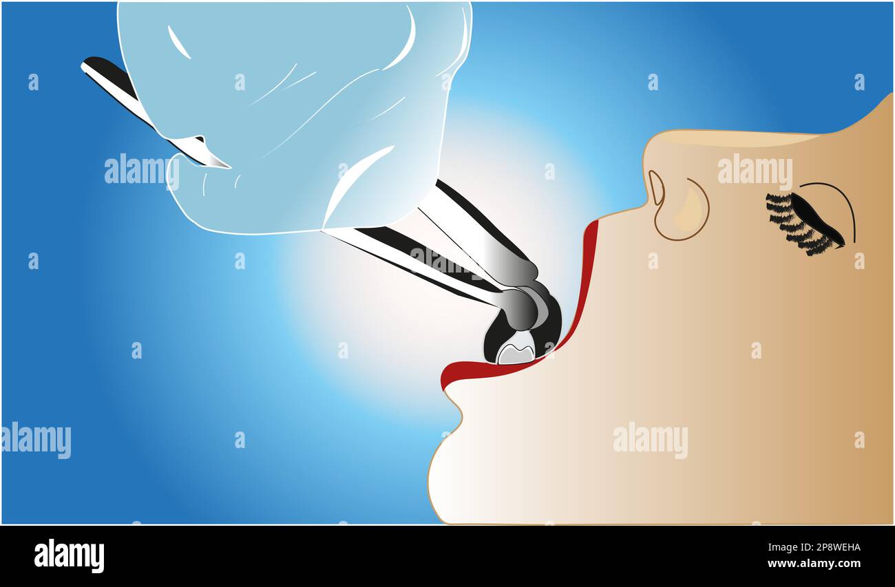 drawing of a doctor pulling out a man's tooth with a tool Stock Vector ...
