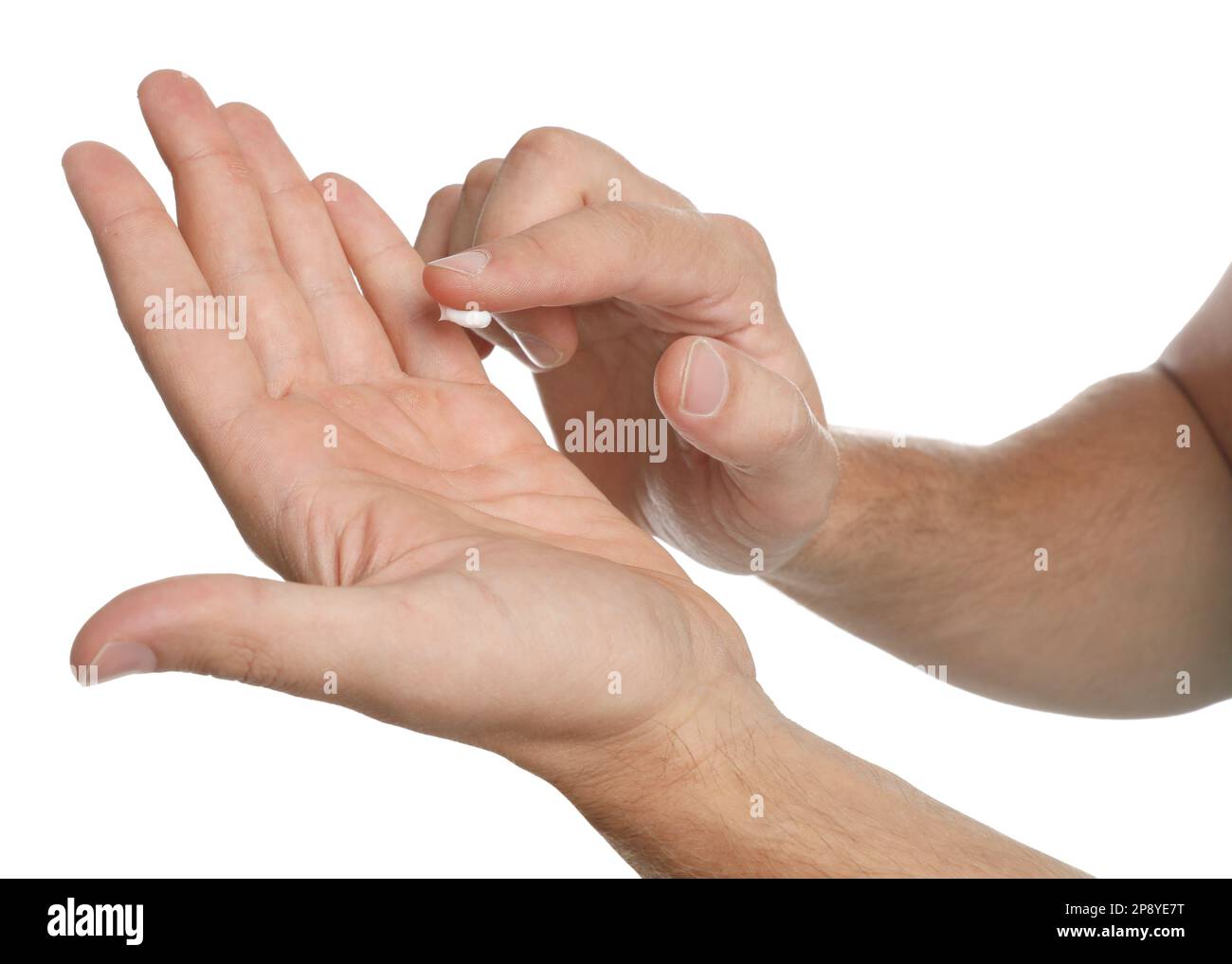 Man applying cream on hand for calluses treatment against white ...
