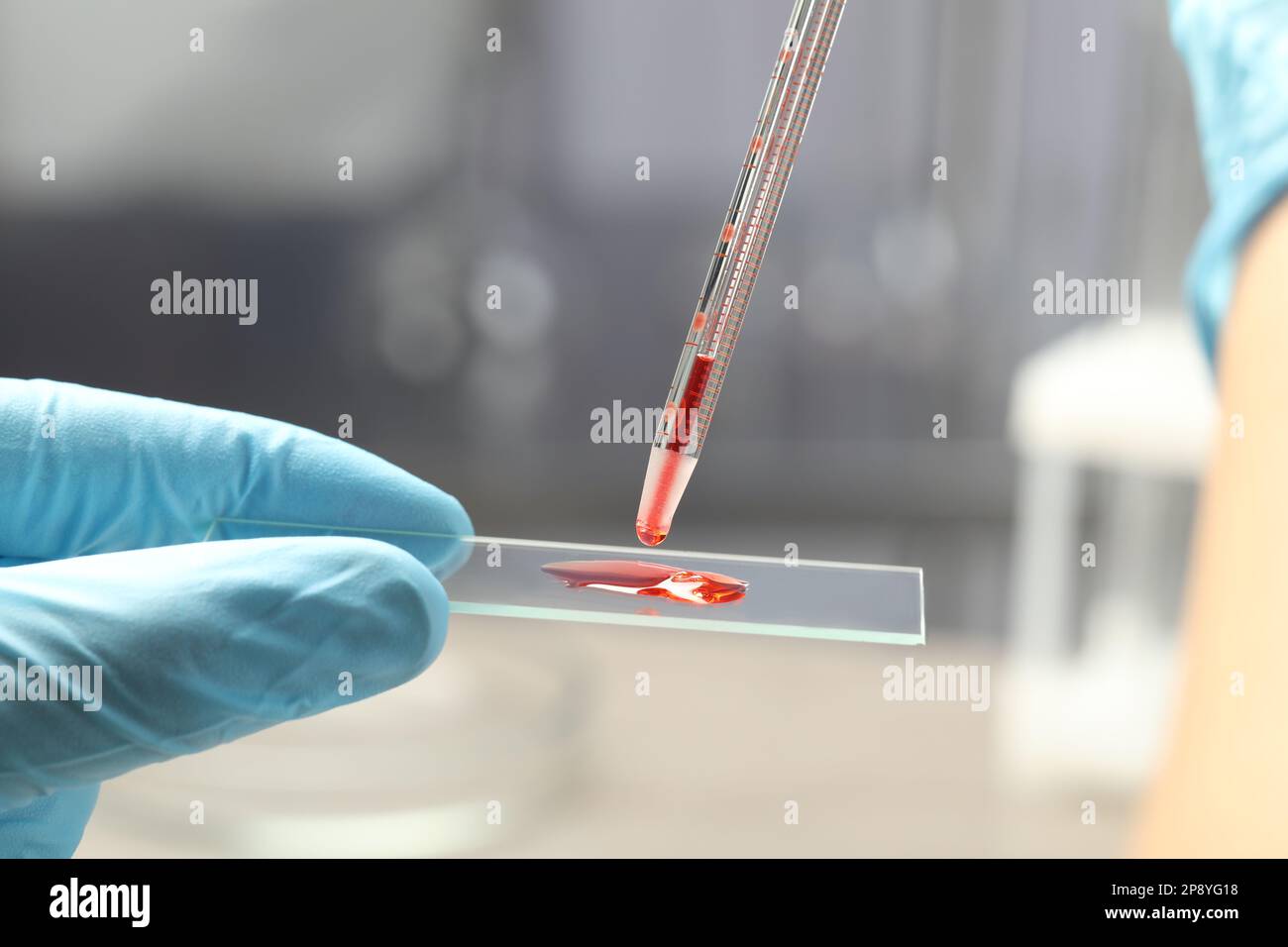 Scientist dripping sample of red liquid onto microscope slide in ...