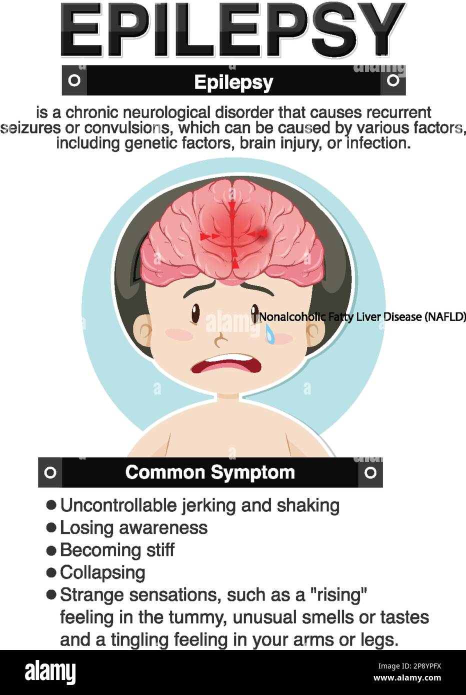 Informative poster of Epilepsy illustration Stock Vector Image & Art ...