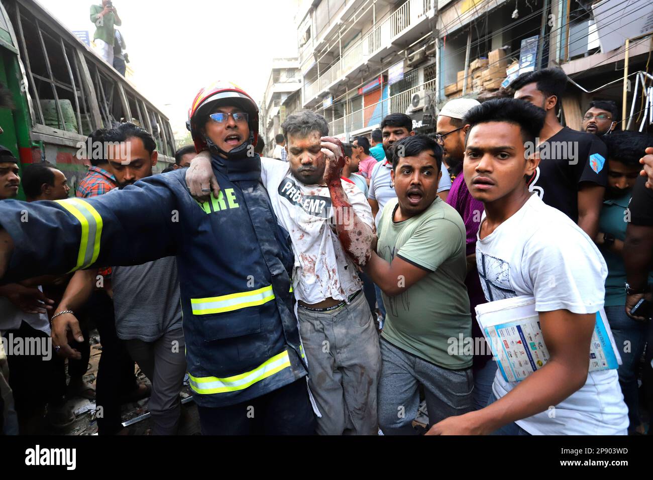 Fire officials and locals carry an injured person to hospital after an ...