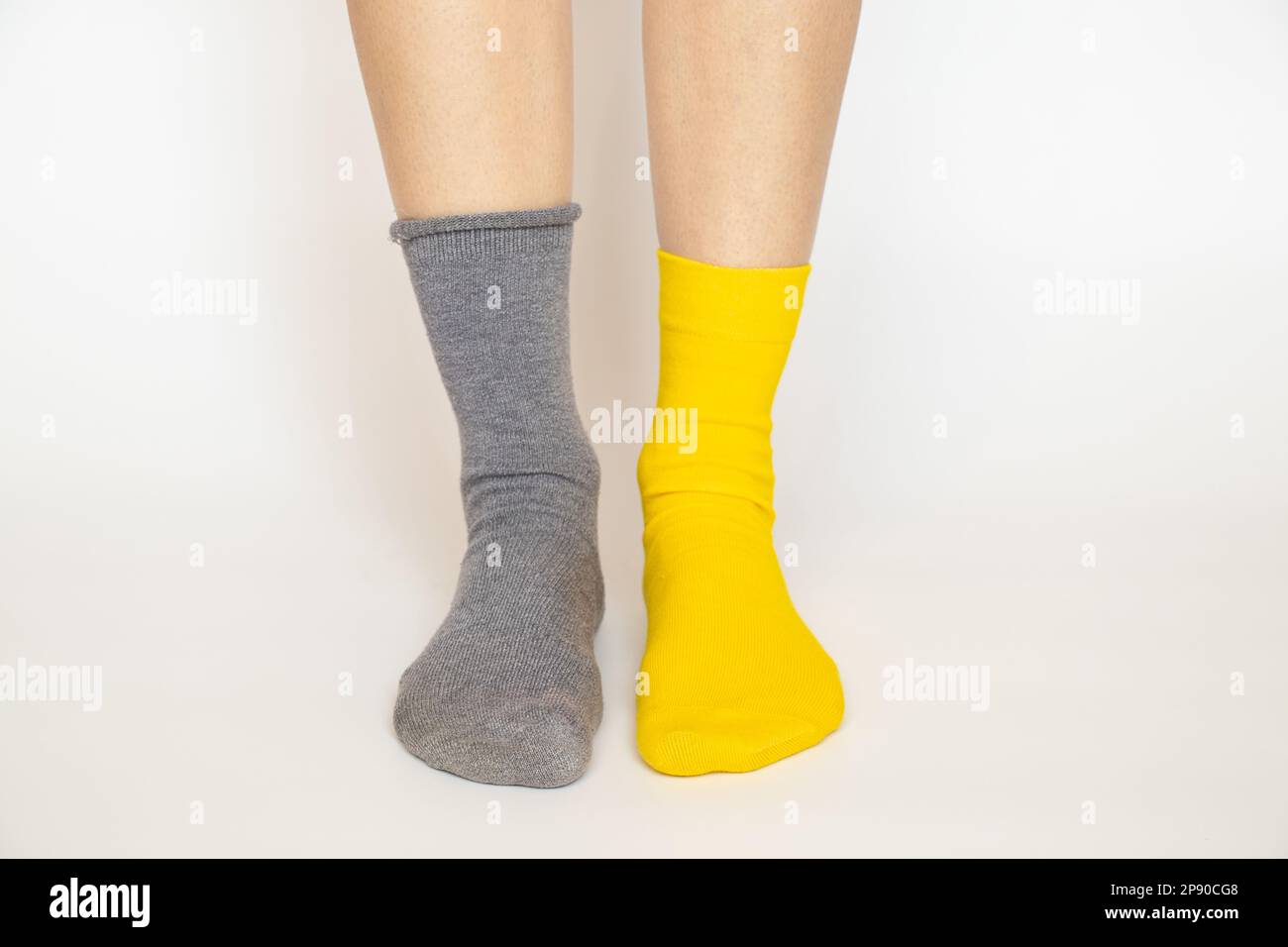 Women's legs in different socks, one is blue and the other is yellow on ...