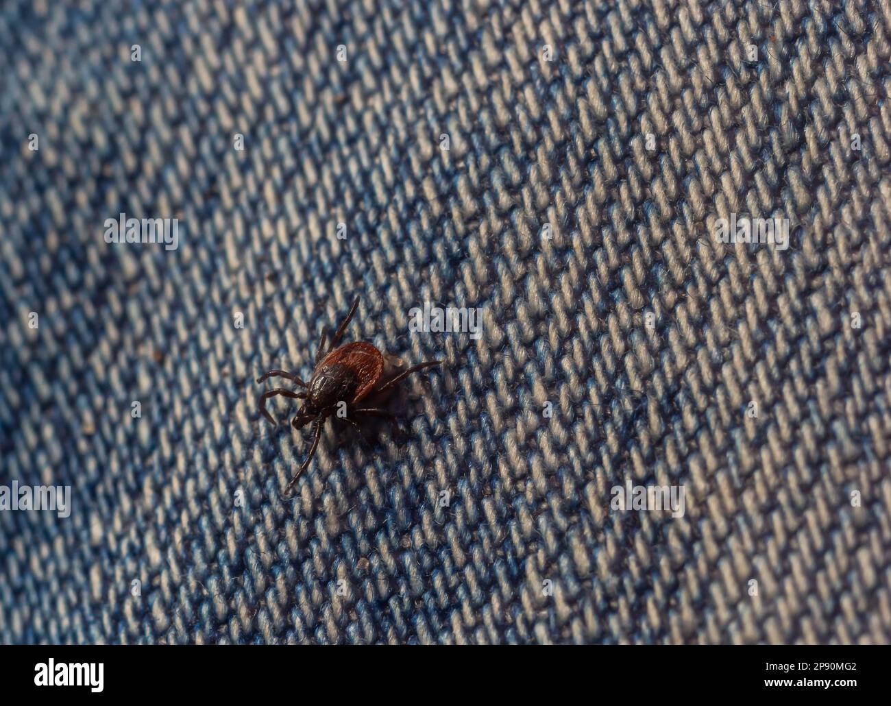 The parasite mite sits on a persons skin. infection carrier. Ixodes ...