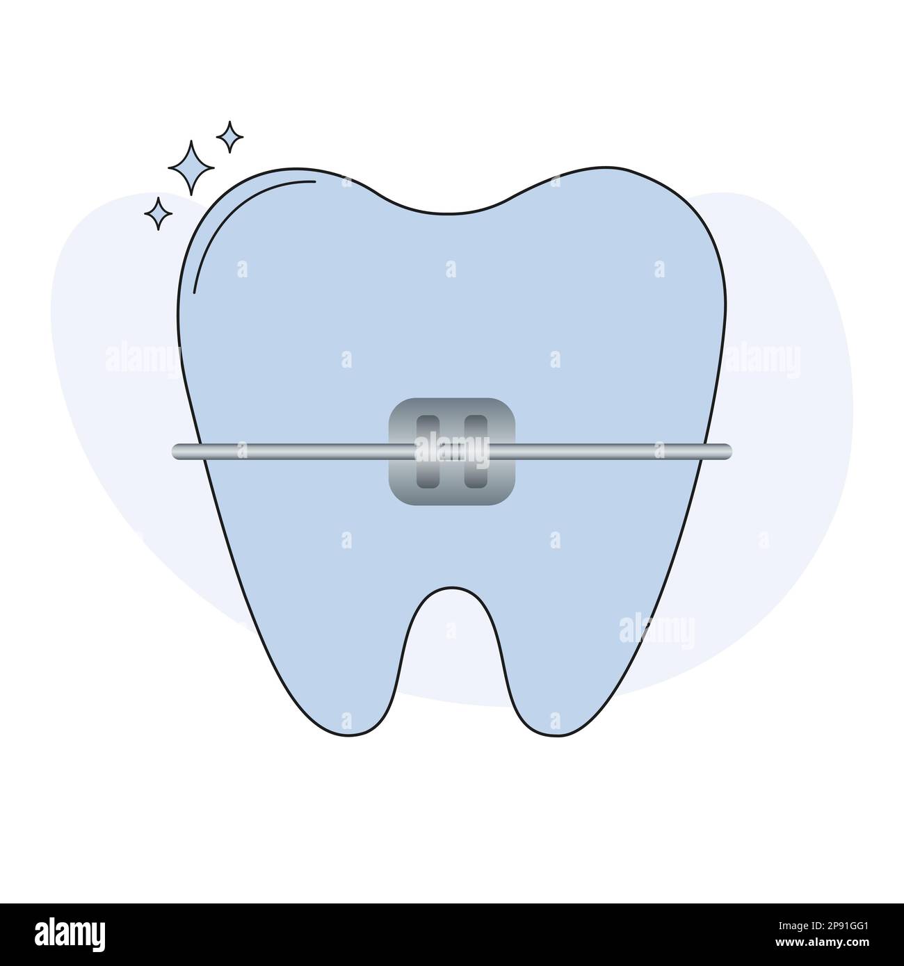 Cute tooth with dental metal braces. Dental braces on tooth orthodontic ...