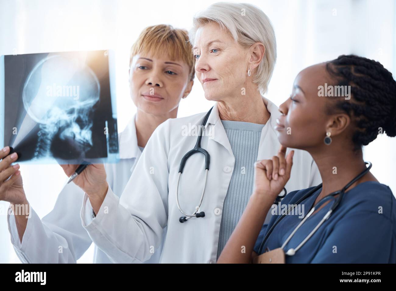 Xray, women doctors and radiology team planning for test, results ...