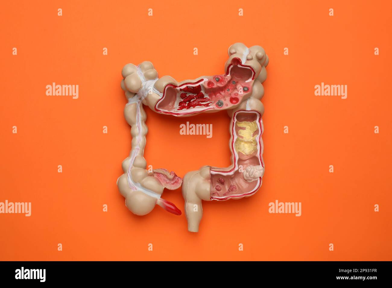 Anatomical model of large intestine on orange background, top view ...