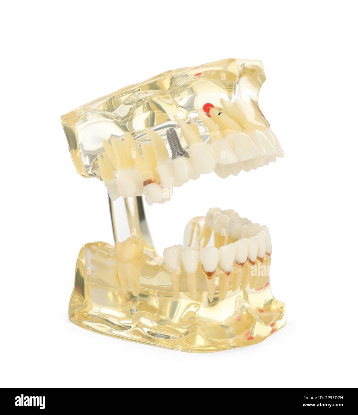 Educational dental typodont model isolated on white Stock Photo - Alamy