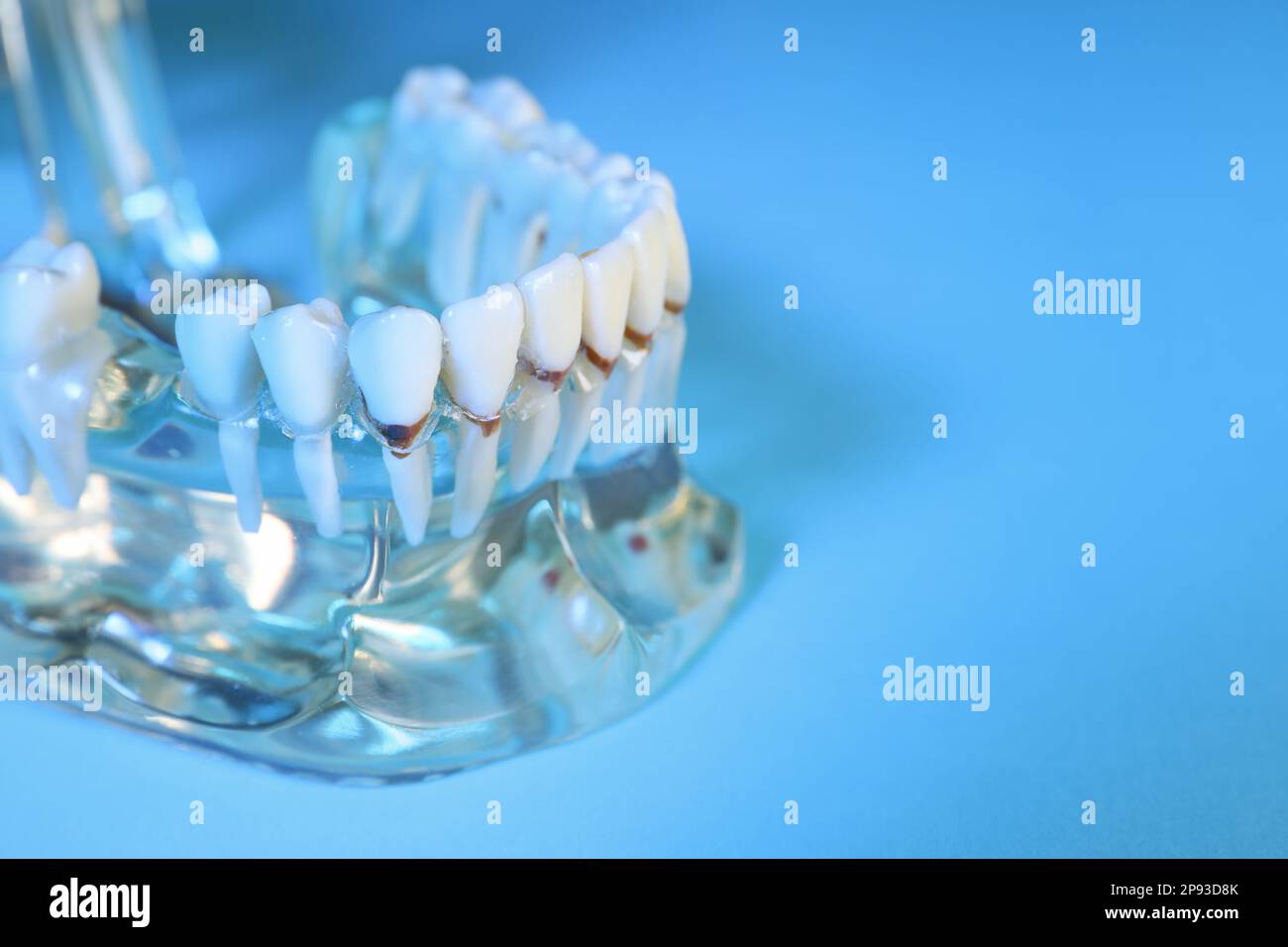 Educational dental typodont model with teeth on light blue background ...