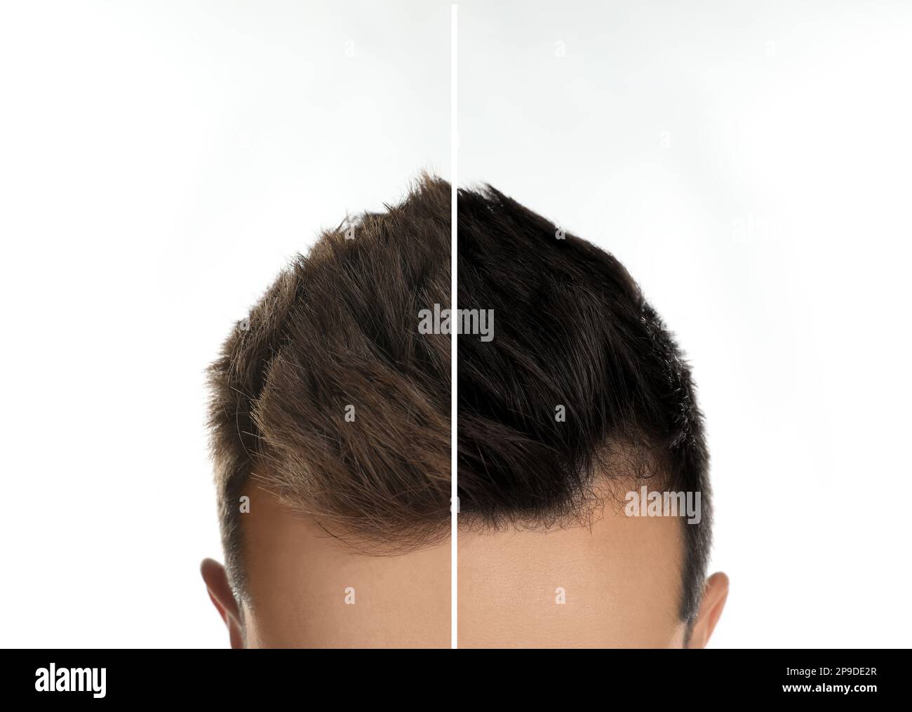 Closeup view of man before and after hair dyeing on light background ...