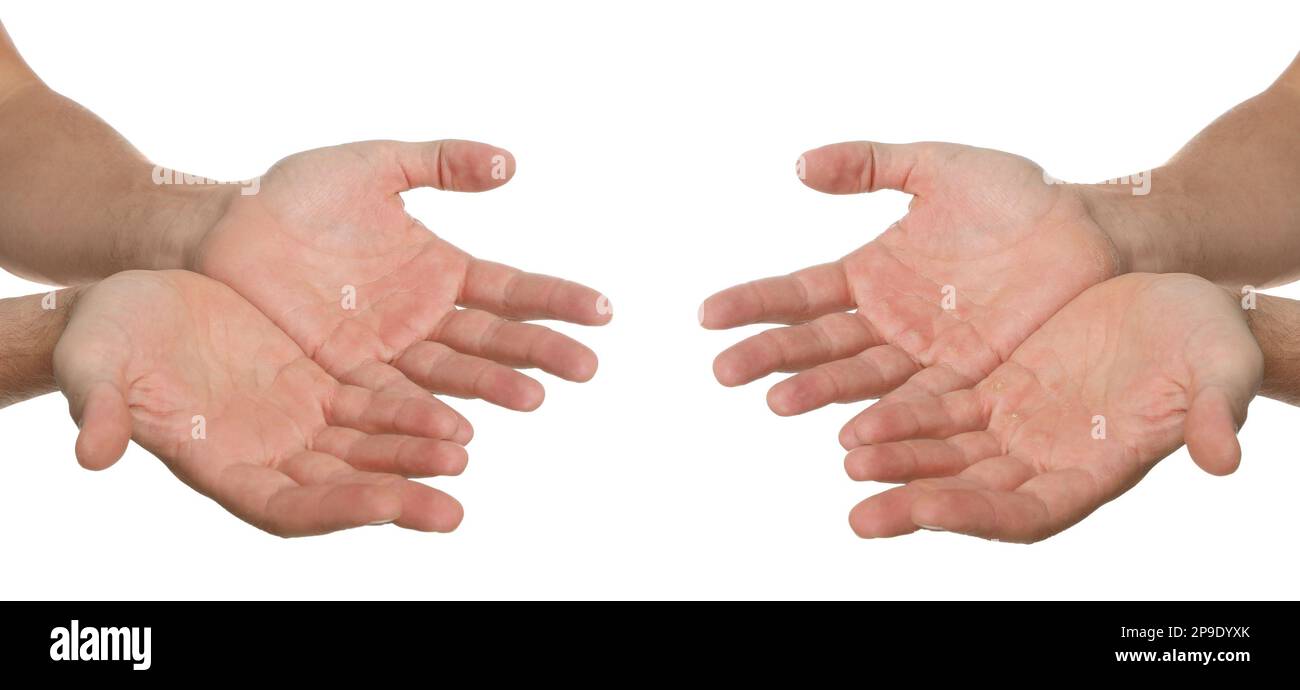 Man showing hands without and with calluses on white background ...