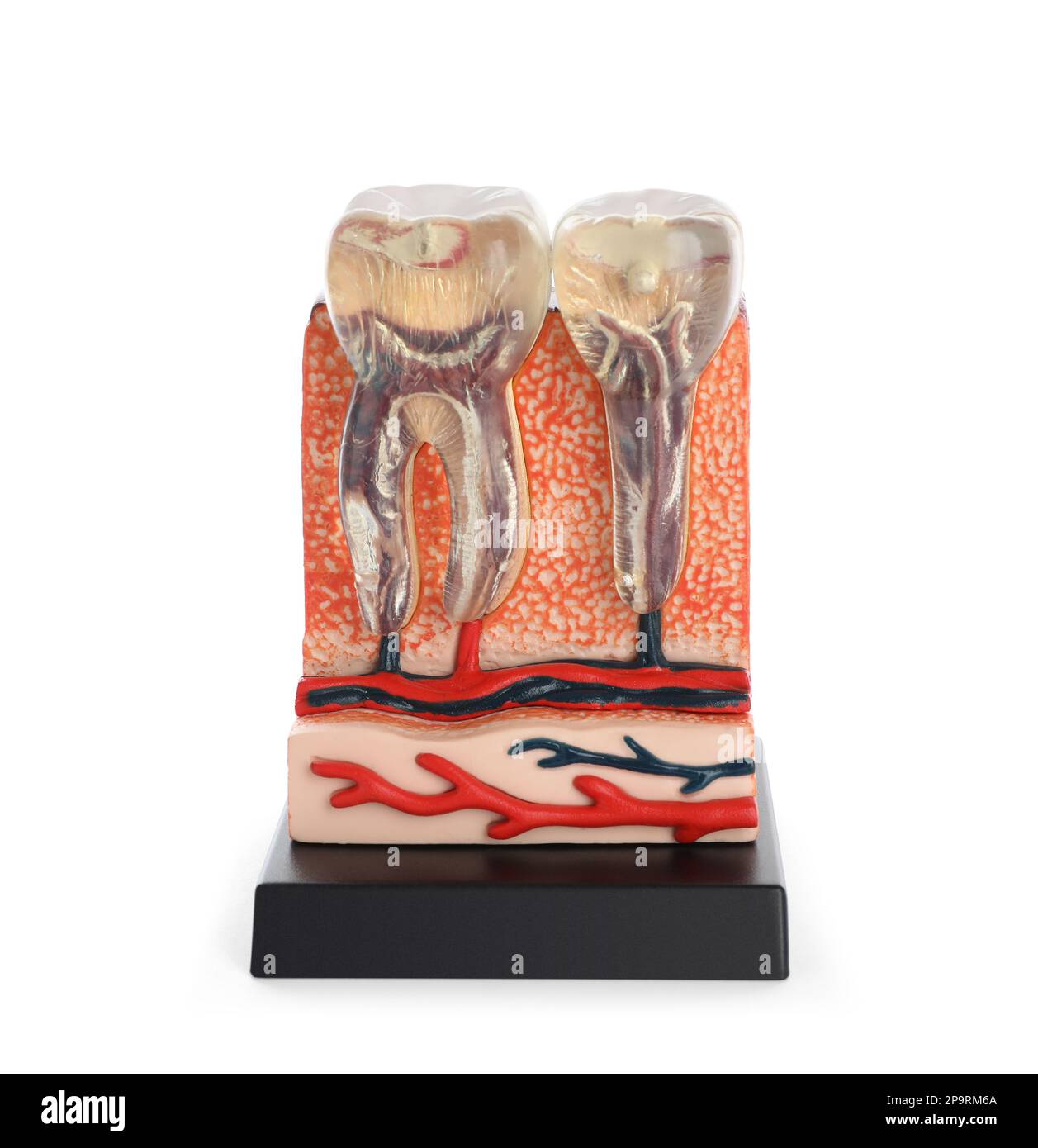 Educational model of jaw section with teeth isolated on white Stock ...