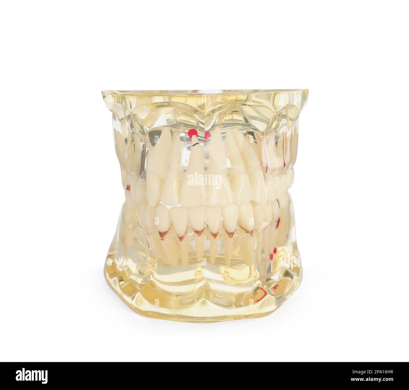 Educational dental typodont model isolated on white Stock Photo - Alamy