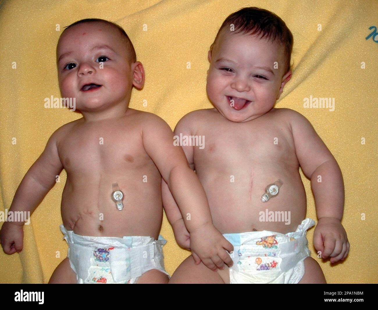 **ADVANCE FOR MONDAY, JUNE 16** Twins Jake Aron, left, and Josh Aron ...