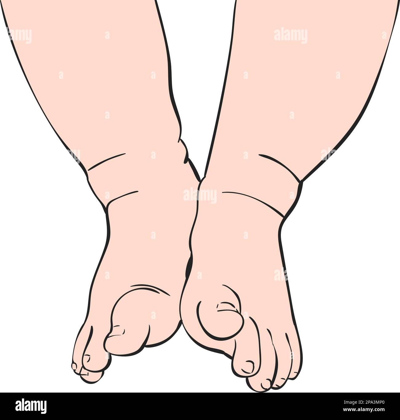 Illustration of baby feet, Hand drawn vector line art colored sketch ...