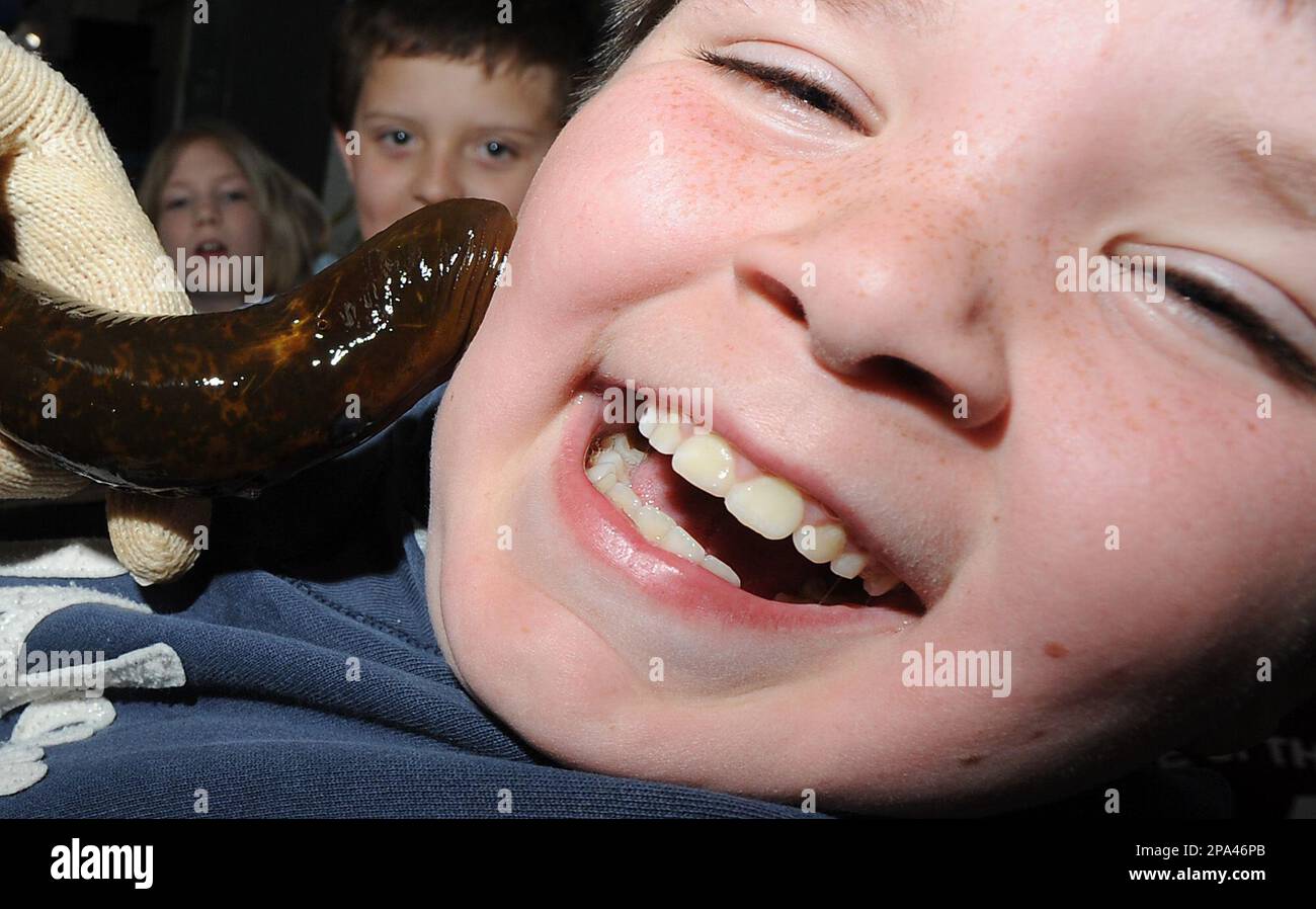 A lamprey grabs hold of Ryan McMahon's cheek during Barb Wangerin's ...