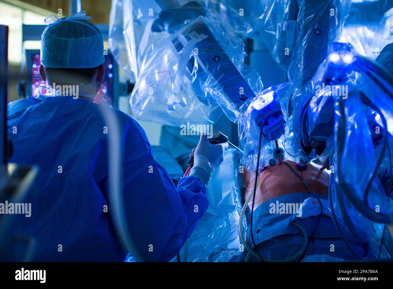 Prostate robotic surgery. Surgery room in a modern hospital with top ...