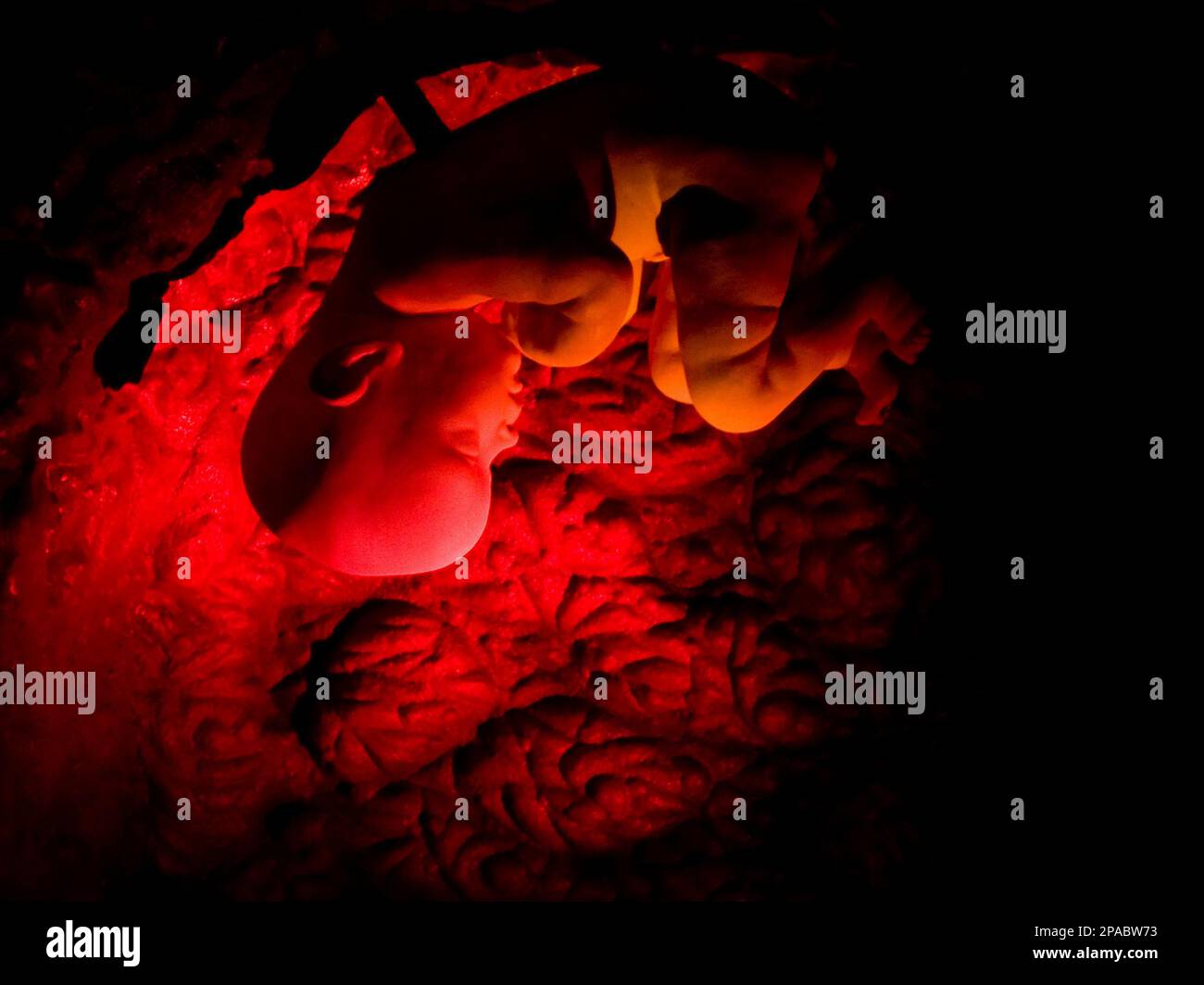 A human embryo is shown in a three-dimensional film on human ...