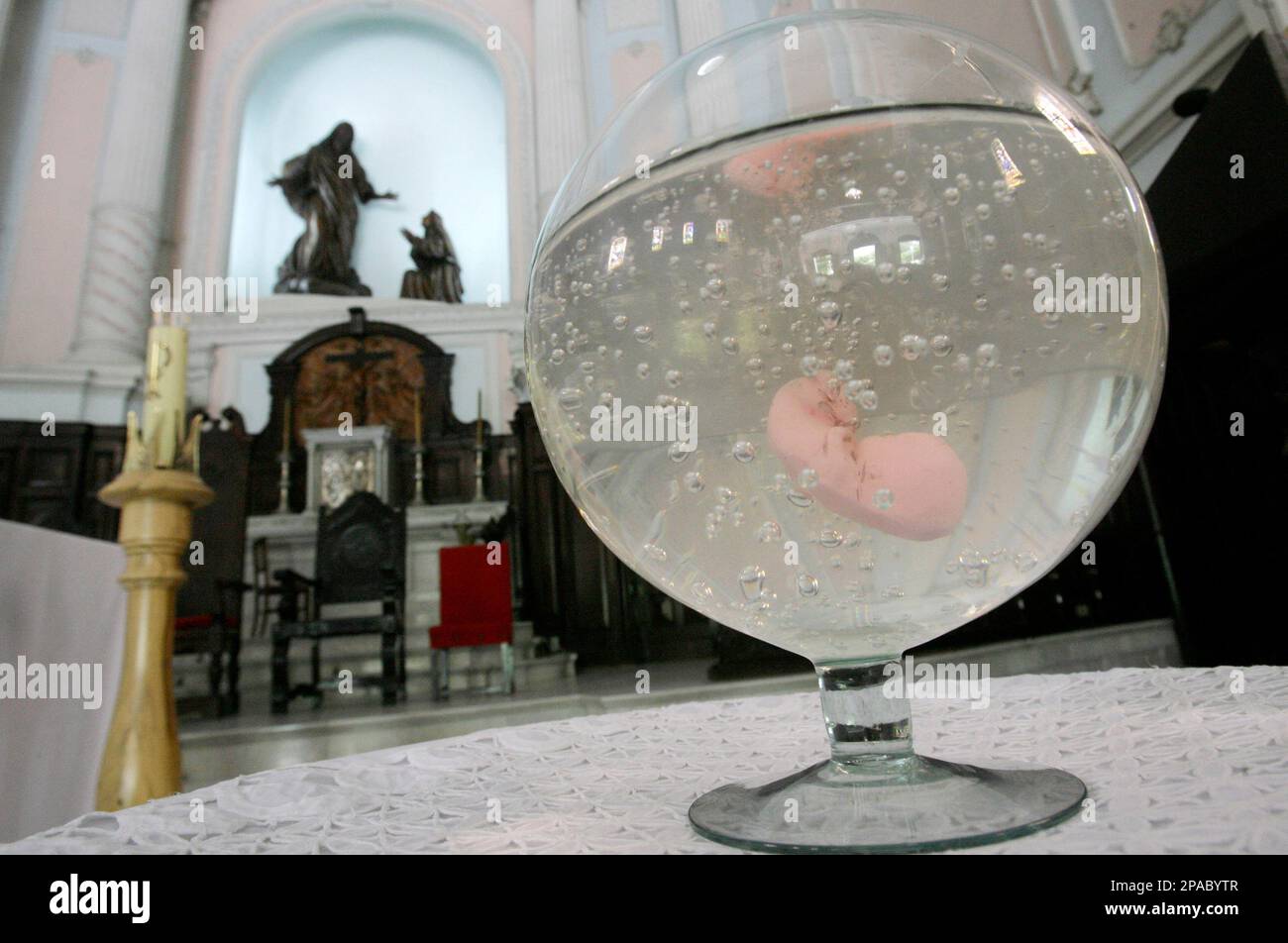 A plastic figure depicting a human fetus is seen on display inside a ...