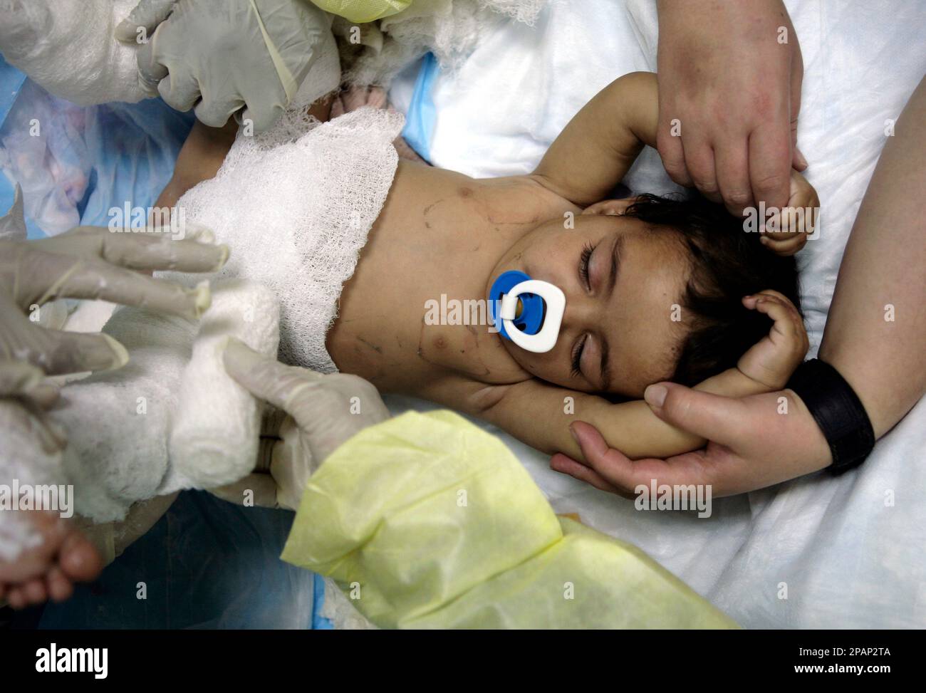 U.S. Army medical staff change the dressings on eight-month-old Saja ...