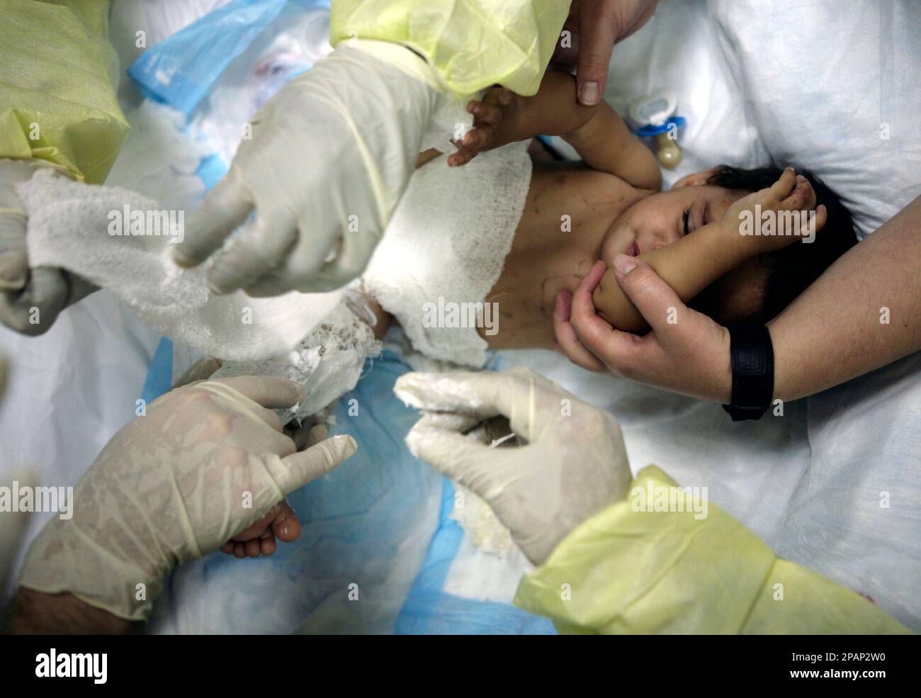 U.S. Army medical staff change the dressings on eight-month-old Saja ...