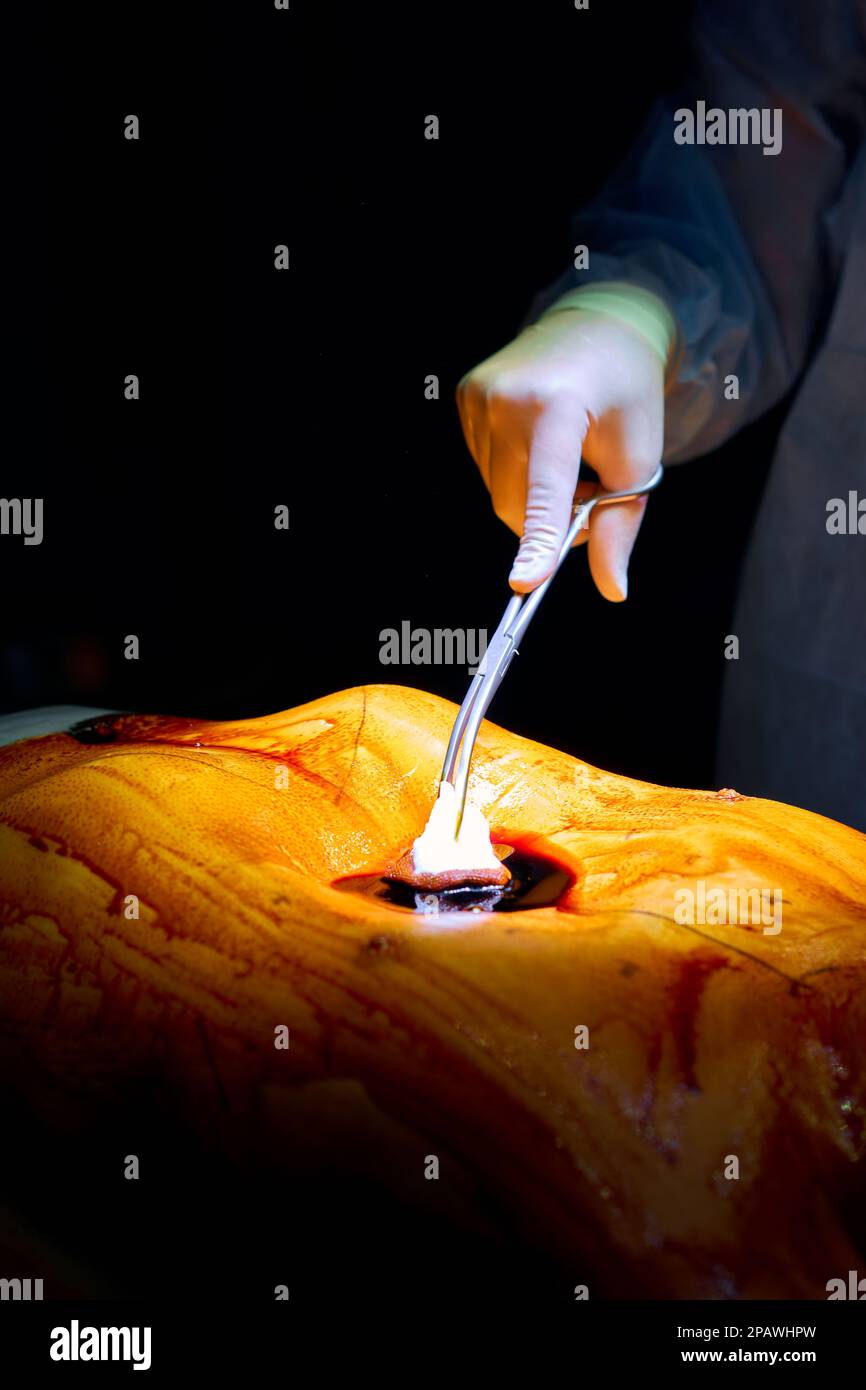 Surgeon holding surgical instruments hi-res stock photography and ...