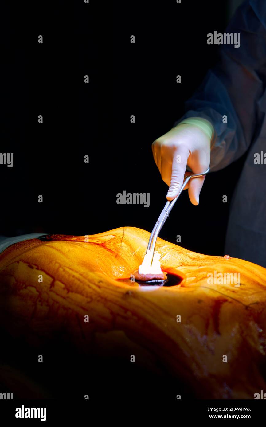 Surgeon holding surgical instruments hi-res stock photography and ...