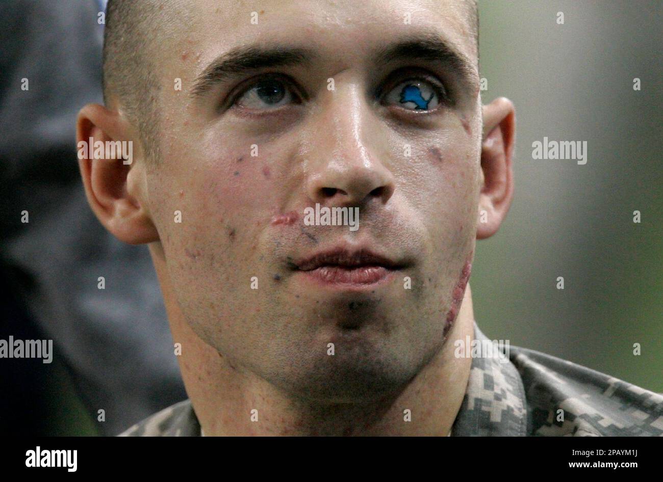 Sgt. Philip LaBonte, who received his Purple Heart during the third ...