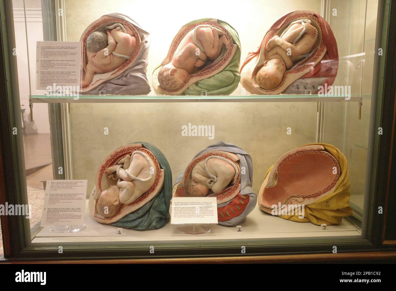 Bologna, Italy - 19 Nov, 2022: Medical exhibits at the Museo di Palazzo ...