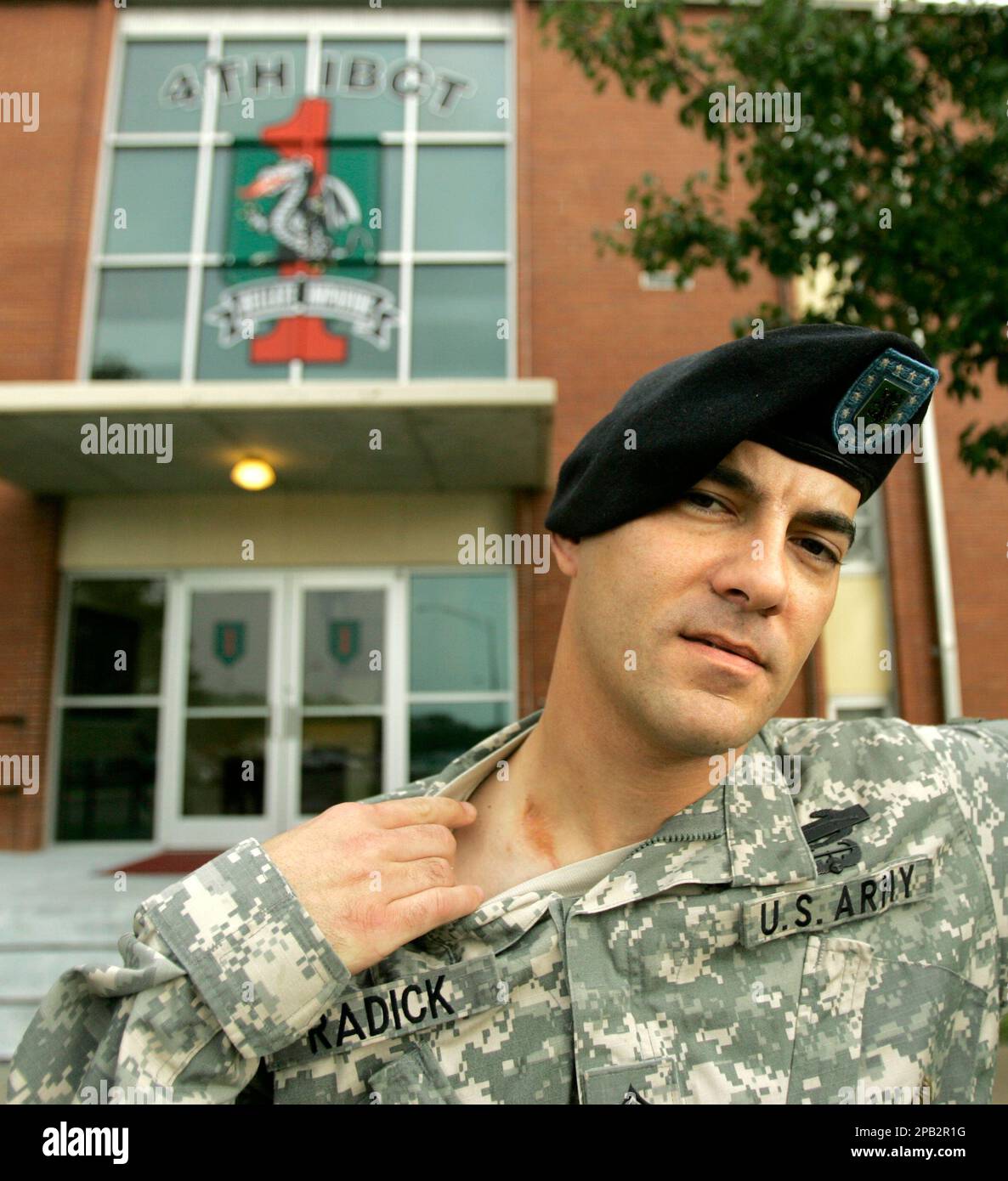 U.S. Army Staff Sgt. Walter Radick shows the scar where he was shot on ...