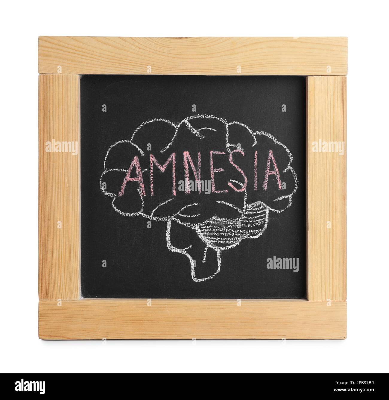 Blackboard with drawn brain and word Amnesia on white background Stock ...