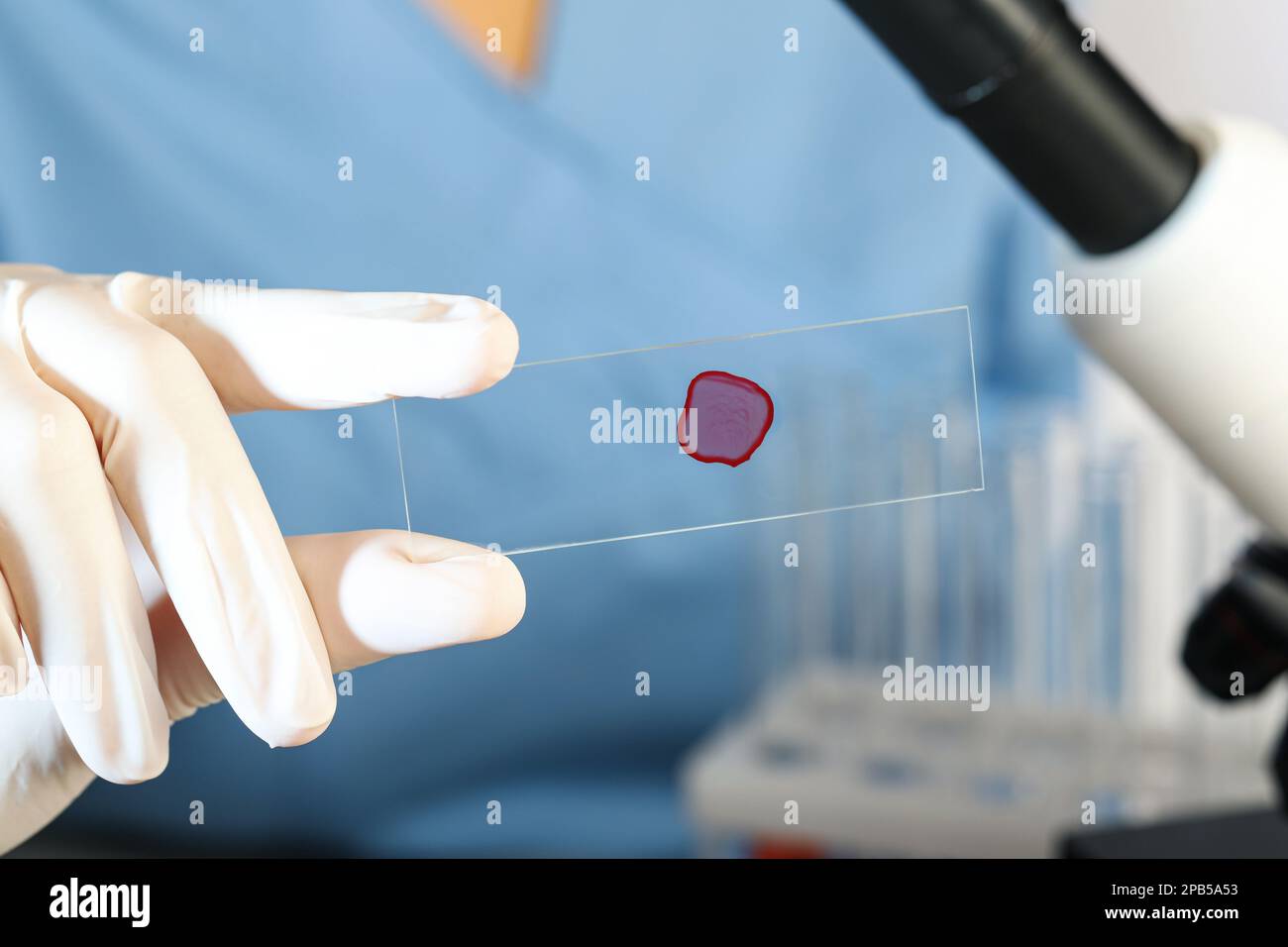 Scientist holding microscope slide with red sample in laboratory ...