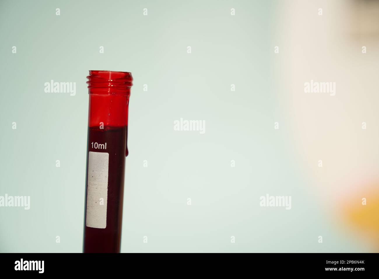 A test tube with blood on a light background. Transparent test tubes ...