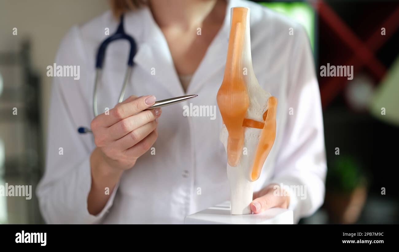 Rheumatologist points anatomical model hi-res stock photography and ...
